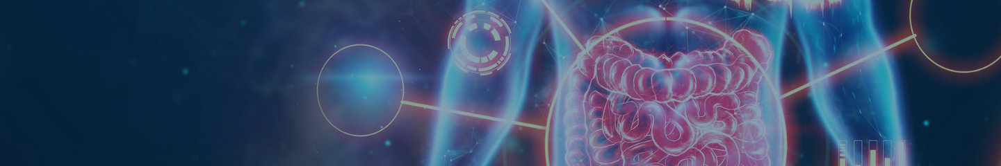 UEGW Poster Presentations - Alimentiv