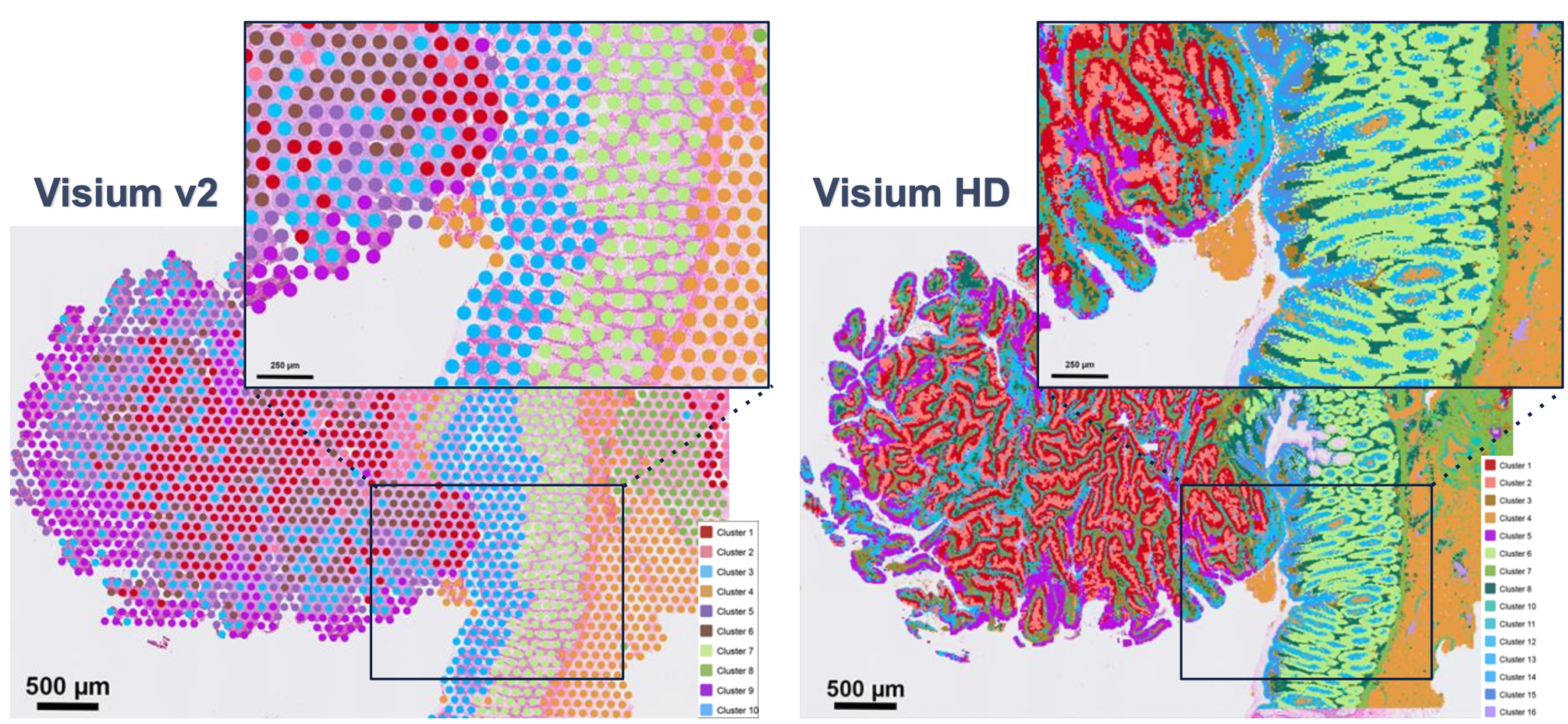 Histopathology Expertise Supports Spatial Transcriptomics Analysis ...